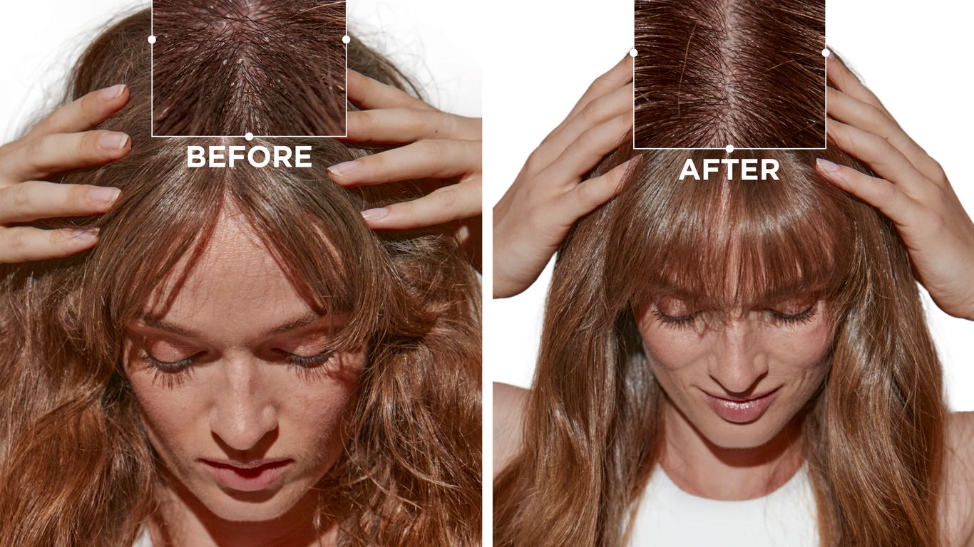 Discover the Best Traitement Cheveux for Healthier, Stronger Hair ...