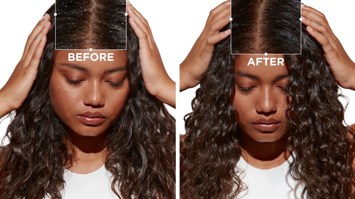 Straight Hair vs Curly Hair: Unpacking the Differences and Debunking ...
